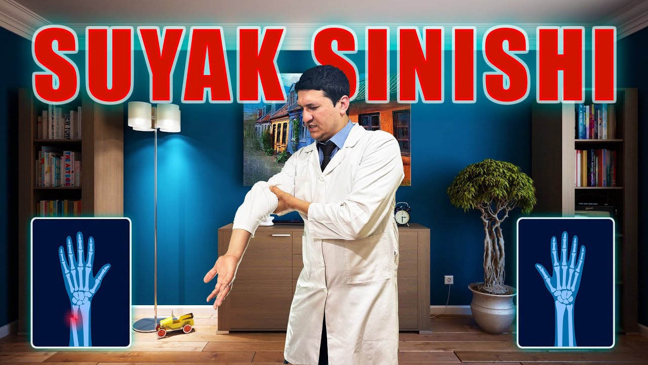 Suyak sinishi belgilari (14 savol).Суяк синиши белгилари - YouTube