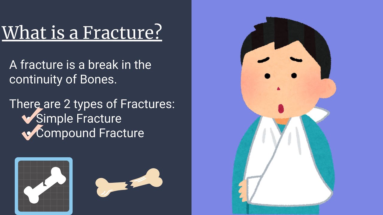 Simple Fracture and Compound Fracture of Bones | Steps of Healing of ...