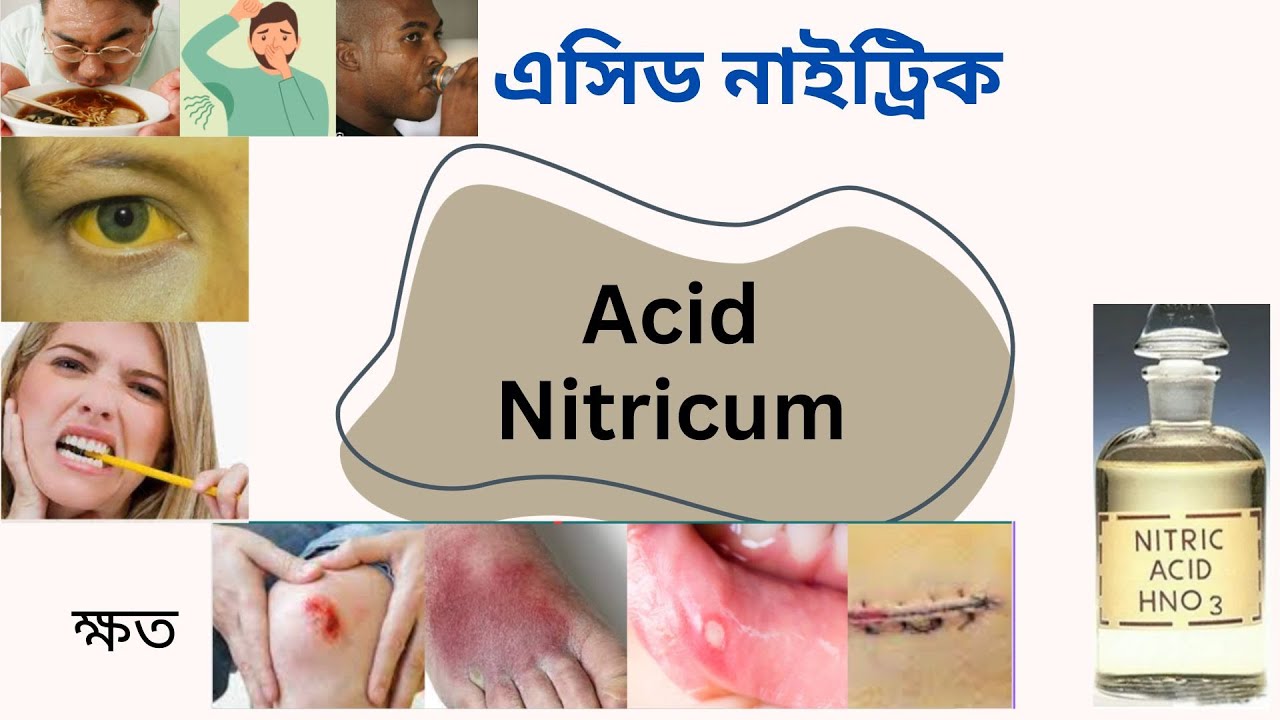 05. Acid Nitricum l এসিড নাইট্রিক l মেটেরিয়া মেডিকা l Materia Medica ...