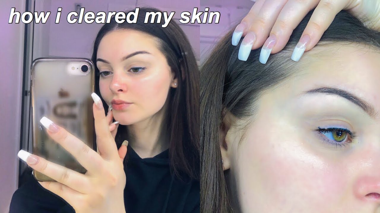 my skincare routine + how I cleared my dry textured skin - YouTube