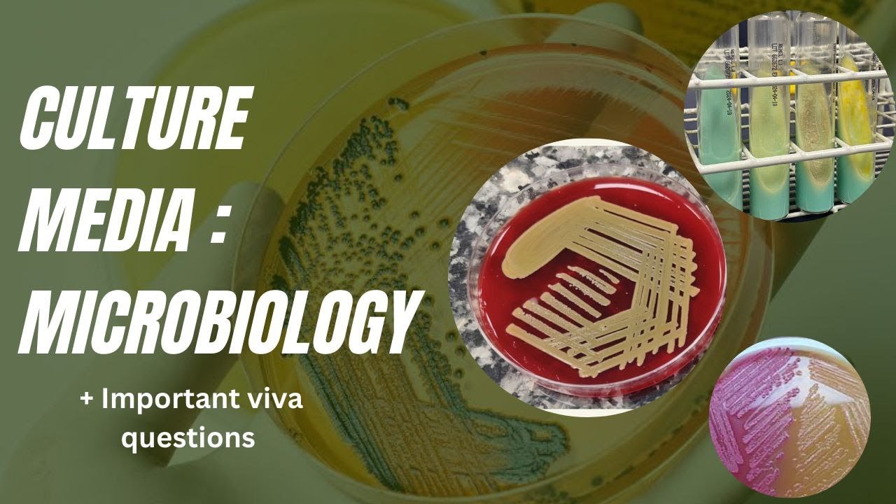 CULTURE MEDIA MICROBIOLOGY | TYPES OF CULTURE MEDIA | MBBS MICROBIOLOGY ...
