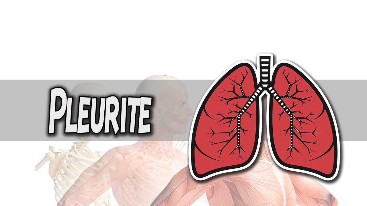 Pleurite Enfermagem Educacional - YouTube