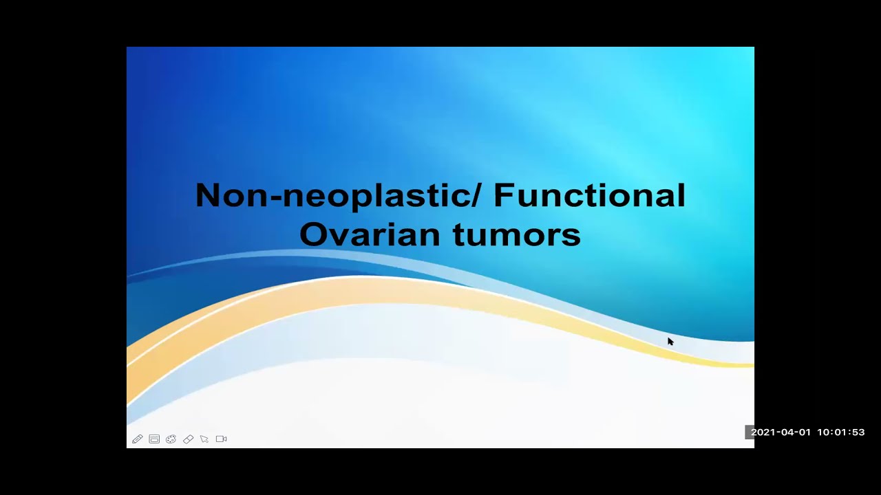 Non neoplastic ovarian tumors - YouTube