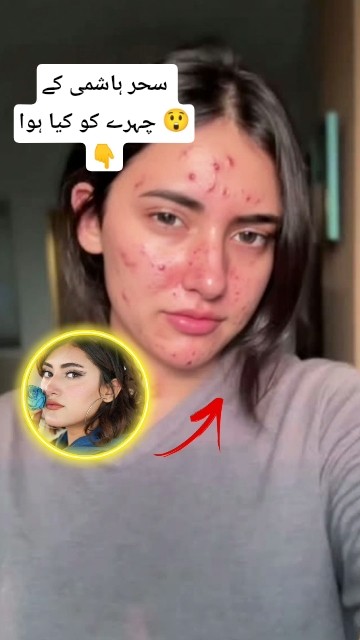 What Happened with Sahar Hashmi Face 😱#youtubeshorts#shortsfeed# ...