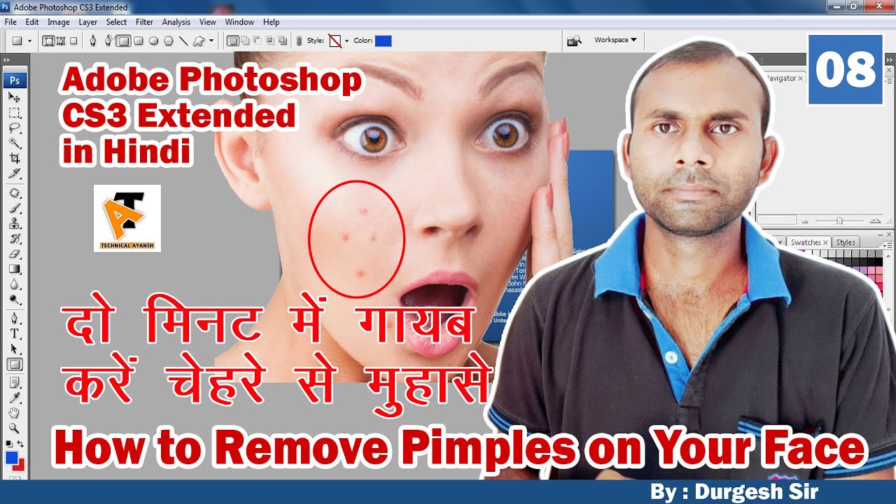 How To Remove Pimples on Your Face in Photoshop | चेहरे से मुहासे कैसे ...