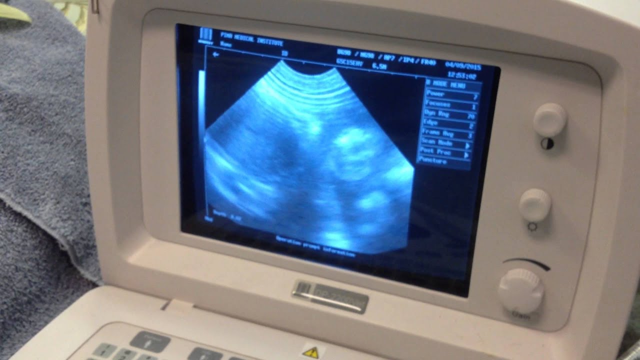 Capybara fetal ultrasound - YouTube