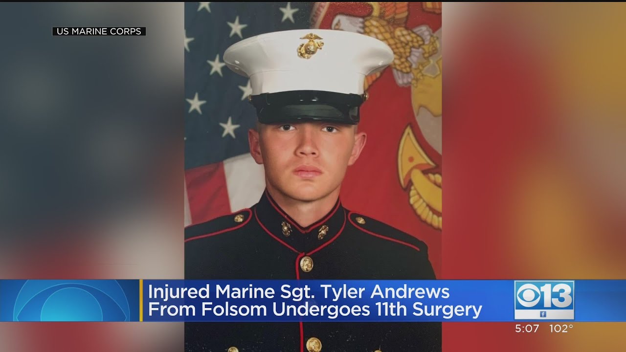 Folsom Marine Injured In Kabul Airport Blast Undergoes 11the Surgery ...