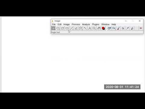Tutorial ImageJ cómo medir distancias en una imagen - YouTube