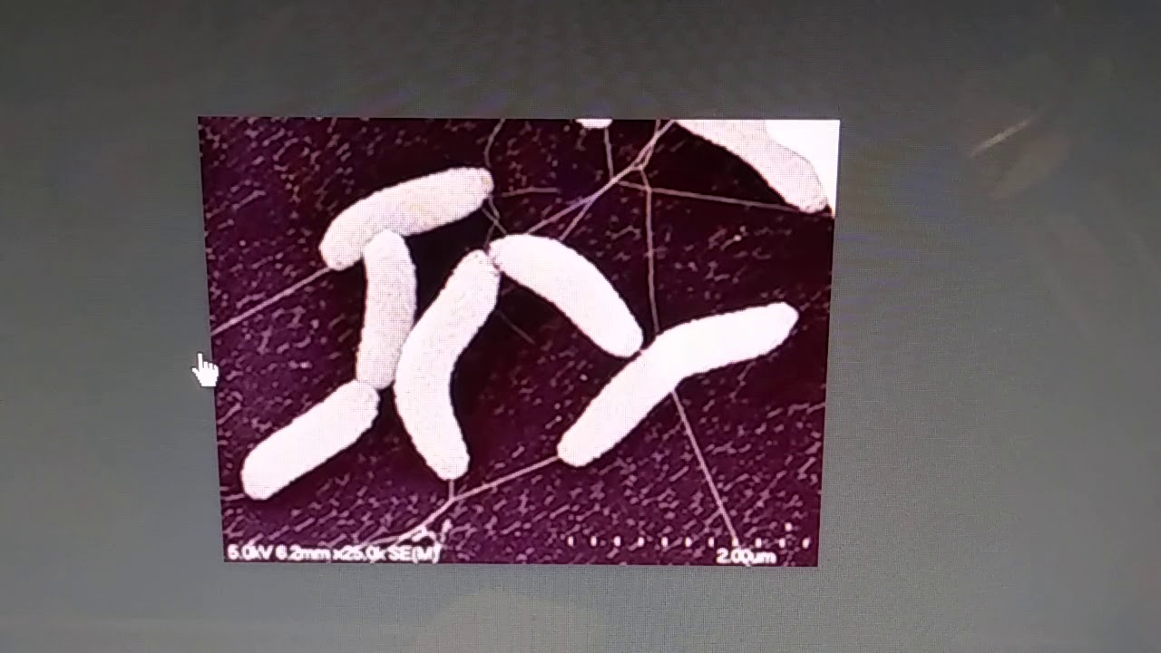 Bacteria as a protien source?WTF?! - YouTube