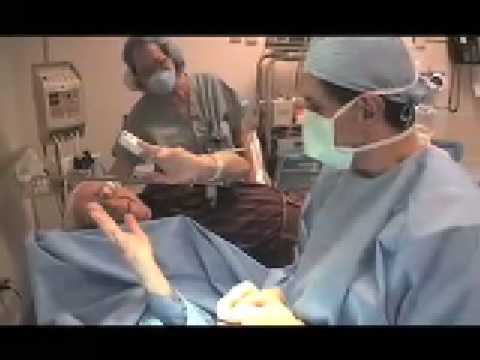 UCLA Procedure Can Free Frozen Fingers - YouTube