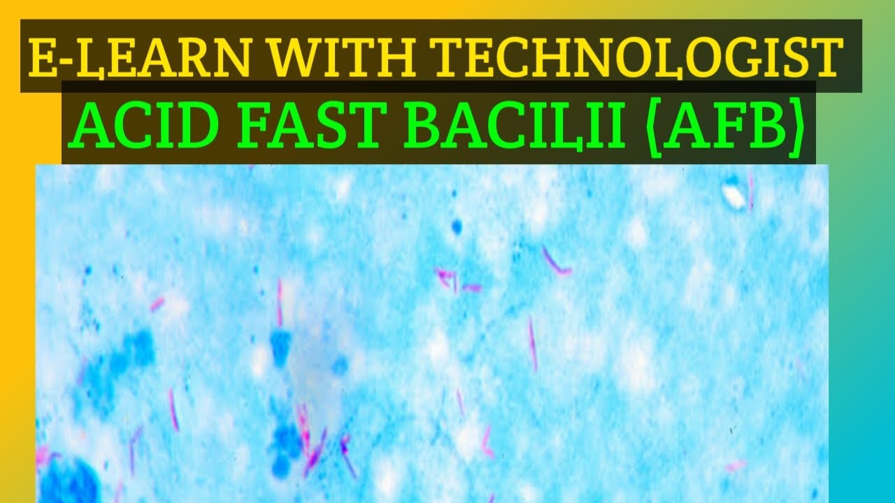 Acid Fast Bacilii (AFB) under Microscope - YouTube