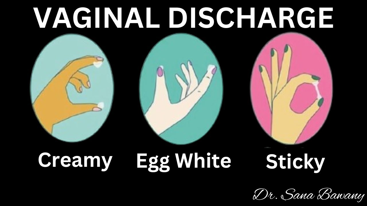 Vaginal Infection||Vaginal discharge|| Yeast Infections | STI| Thrush ...