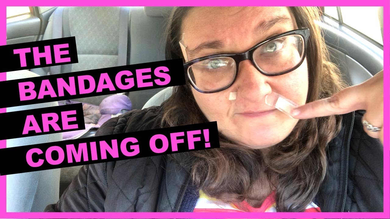 Bandages off! My new face REVEALED! 😀 - YouTube