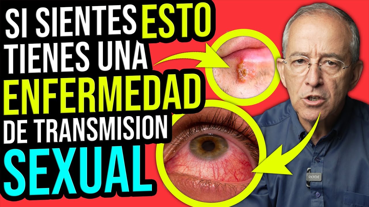 SI SIENTES ESTO TIENES UNA ENFERMEDAD DE TRANSMISIÓN SEXUAL, SIDA ...