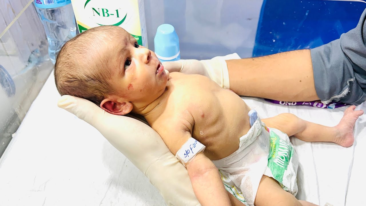 How to Give Formula Trial Feeding in NICU Baby | Step-by-Step Nursing ...