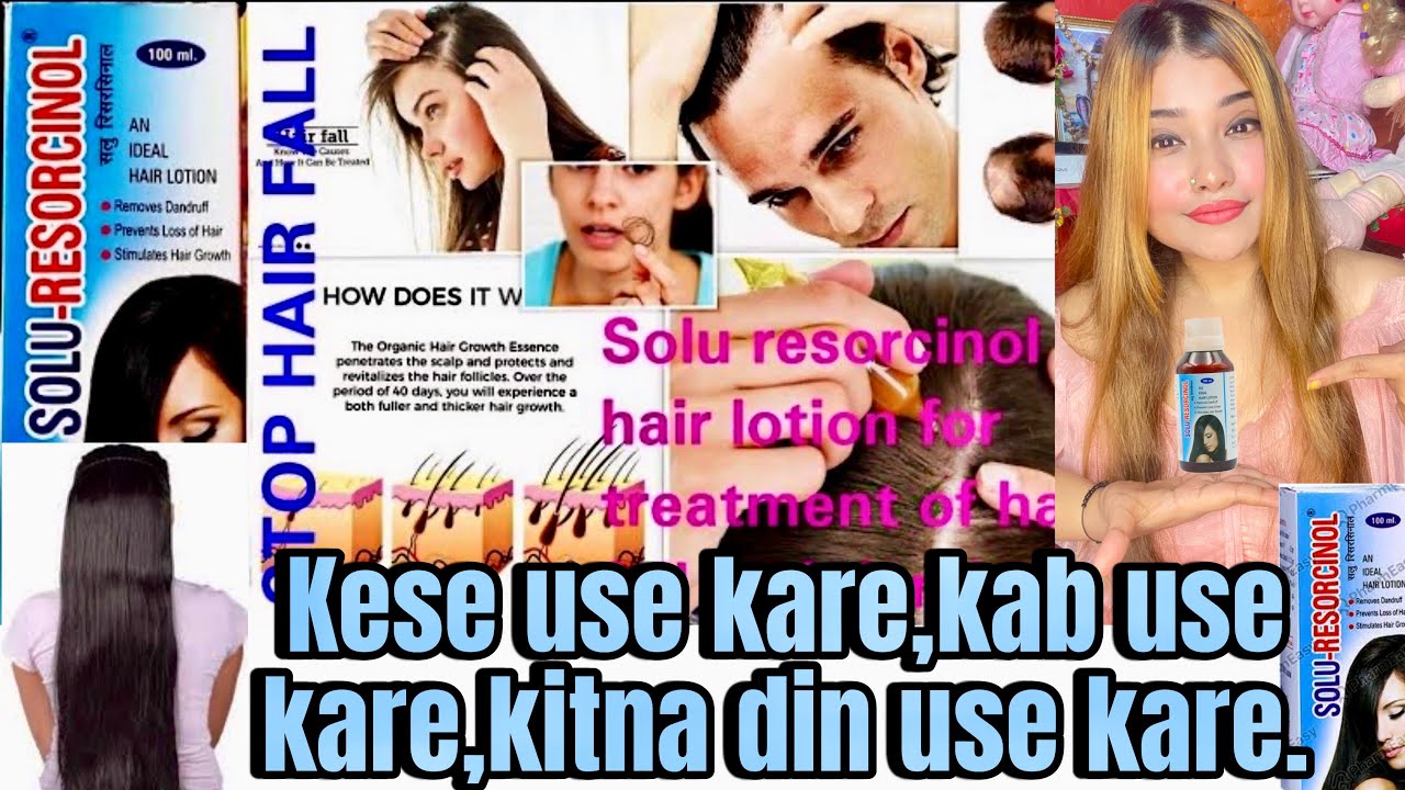 Solu Resorcinol Hair Lotion||Top 1 Allopathy hair Lotion for Treatment ...