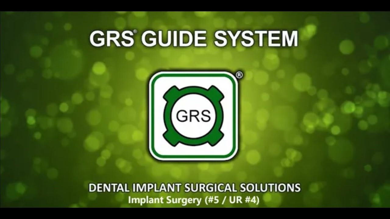 GRS Guide System - Dental Implant Guided Surgery - YouTube