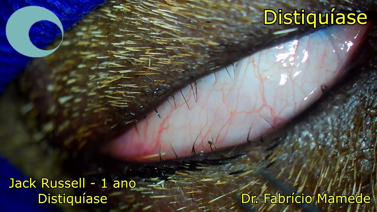 Distiquiase Em Fotos Humanas