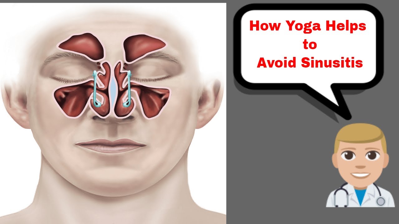 Yoga : How Yoga Helps to Avoid Sinusitis - YouTube