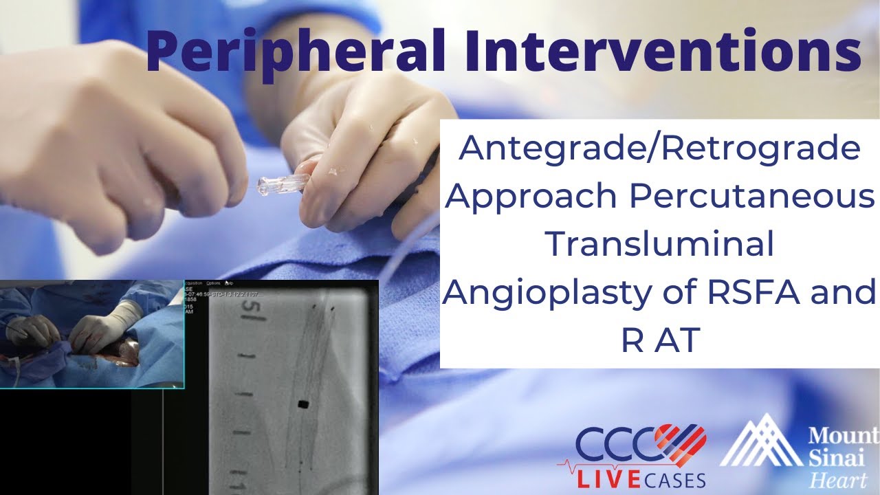 Antegrade/Retrograde Approach Percutaneous Transluminal Angioplasty of ...