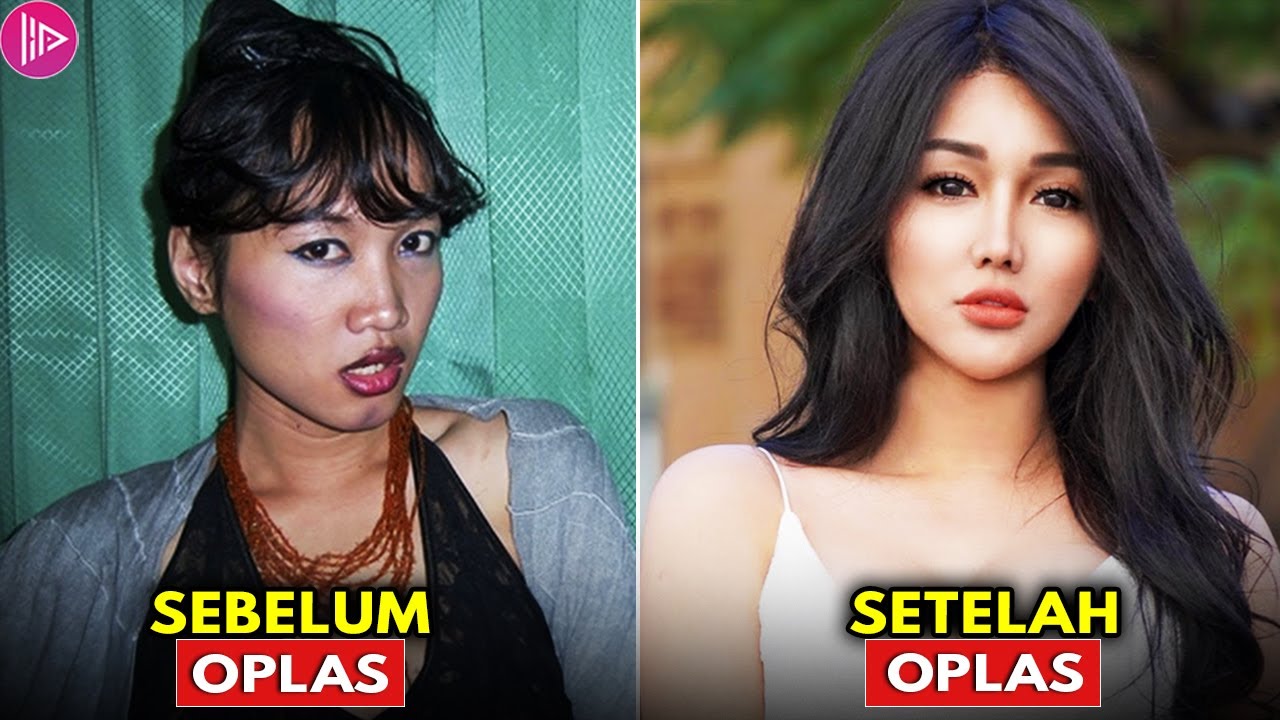 BERUBAH DRASTIS! Artis Rela Habiskan MILIARAN RUPIAH Demi Tampil Cantik - YouTube