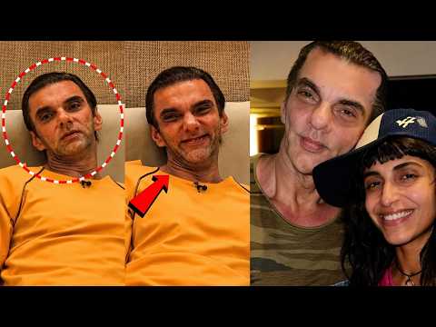 Bad News😪For Salman Khan as Sohail Khan Worsed Health Condition  looks Unrecognizable