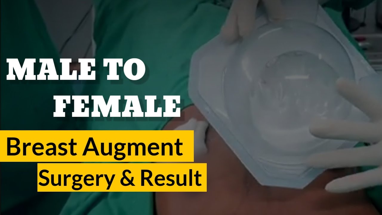 Male to Female Breast Augment surgery & 21 days Result || Silicon Implant | Dr. Jayanta Bain ...