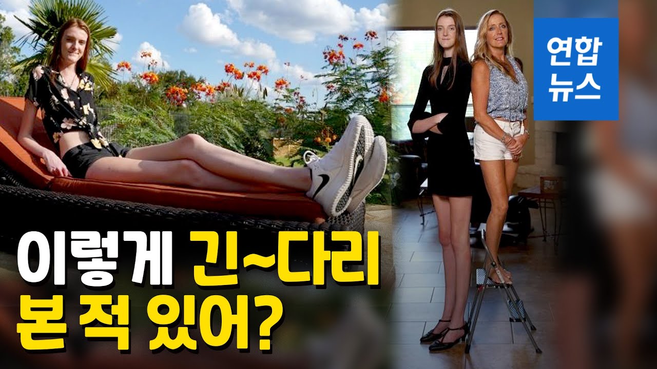 다리 길이만 134cm…세계에서 다리가 가장 긴 17살 소녀 연합뉴스 Yonhapnews Youtube