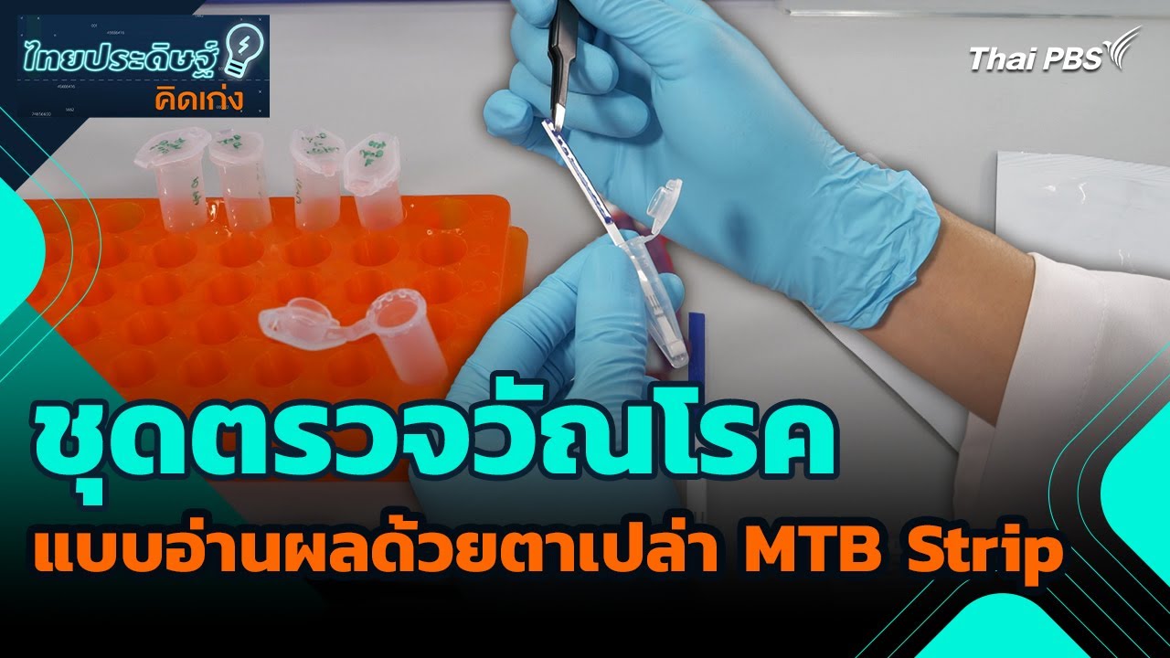 ชุดตรวจวัณโรคแบบอ่านผลด้วยตาเปล่า MTB Strip | ไทยประดิษฐ์คิดเก่ง | วันใหม่วาไรตี้ - YouTube