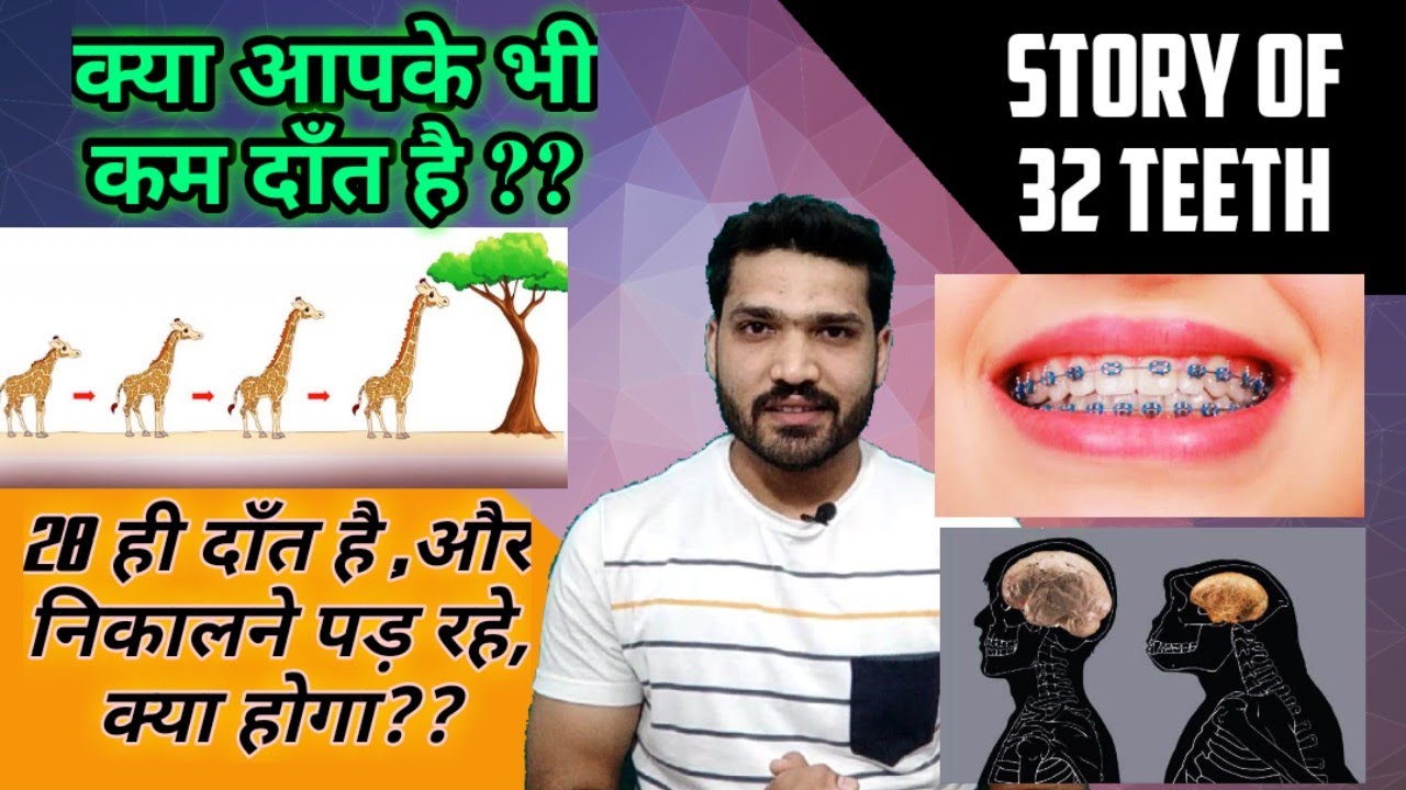 Story of 32 teeth | 32 दाँत क्यों नहीं है? क्या बत्तीस दाँत जरुरी है ...