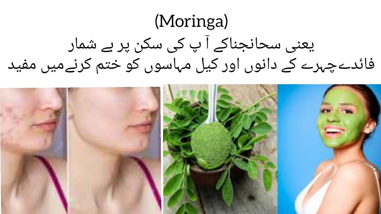 How to treat acne breakouts with Moringa face Pack? how to remove acne ...