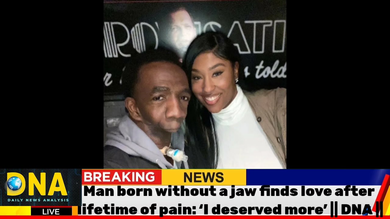 Man born without a jaw finds love after lifetime of pain: ‘I deserved ...