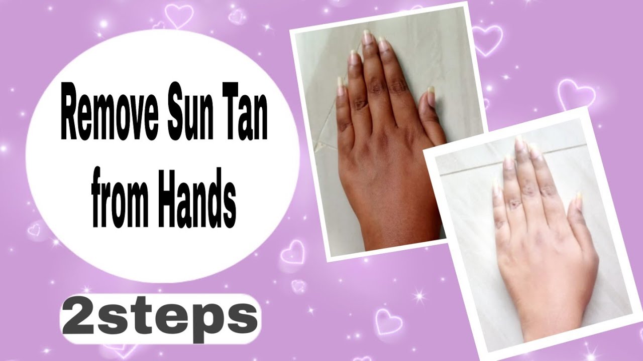 how to remove sun tan from your hand quickly/sun tan home remedie - YouTube