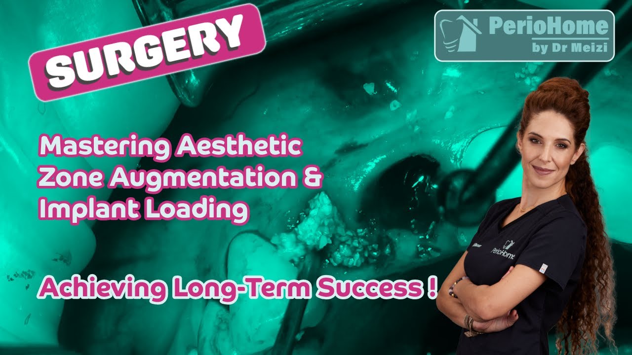 Mastering Aesthetic Zone Augmentation and Implant Loading | Achieving ...
