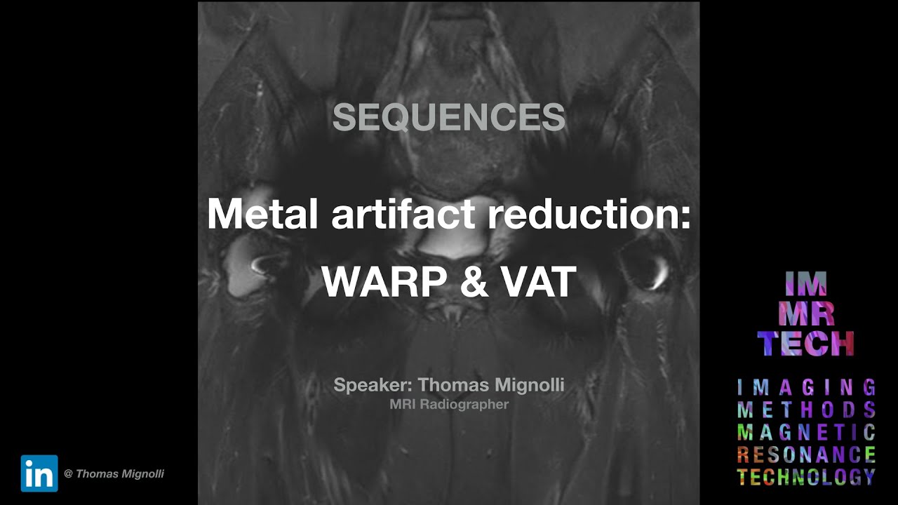 Metal artifact reduction: WARP & VAT - YouTube