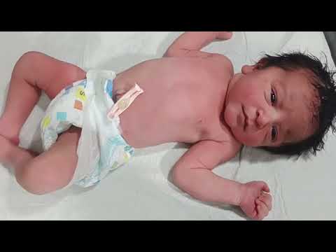 Day-44 baby treatment🩺😷.!#aiims#nicu#hospital#medicallife#newbornbaby# ...