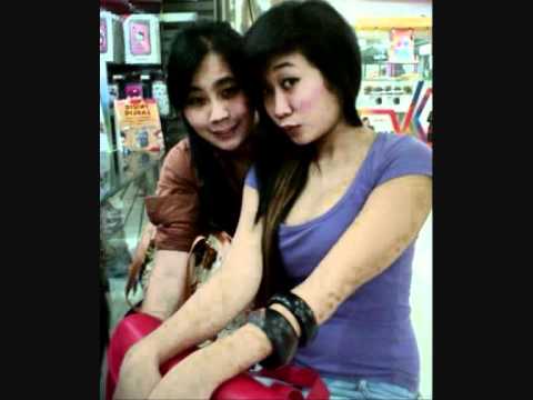 hotpant igo