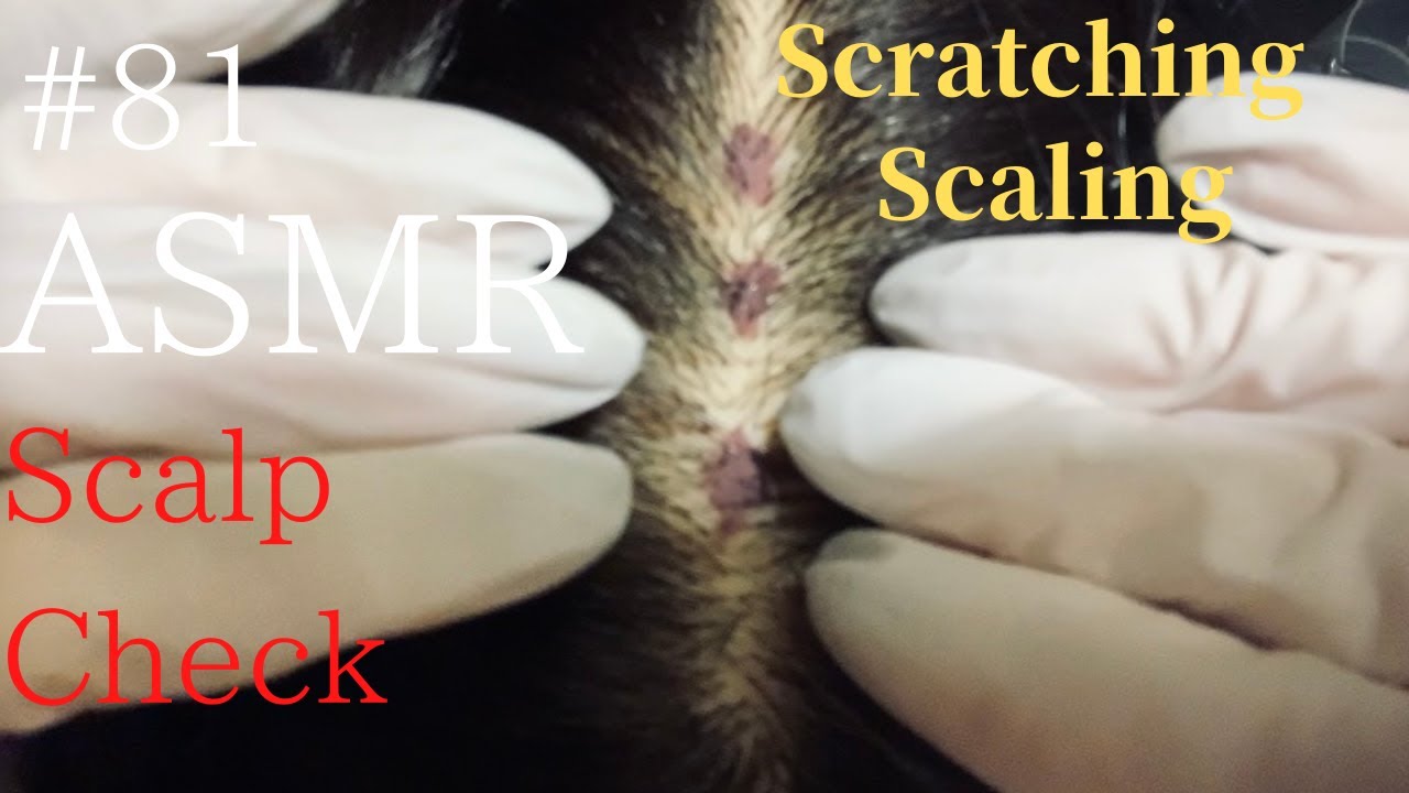[ASMR]#81 Scalp Check / Lice Check / Scaling / role play no talking ...