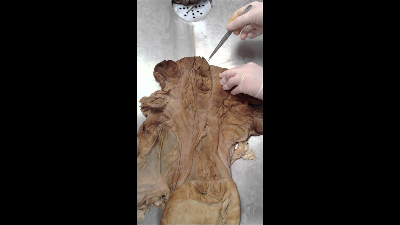 Uterus of a cow - YouTube