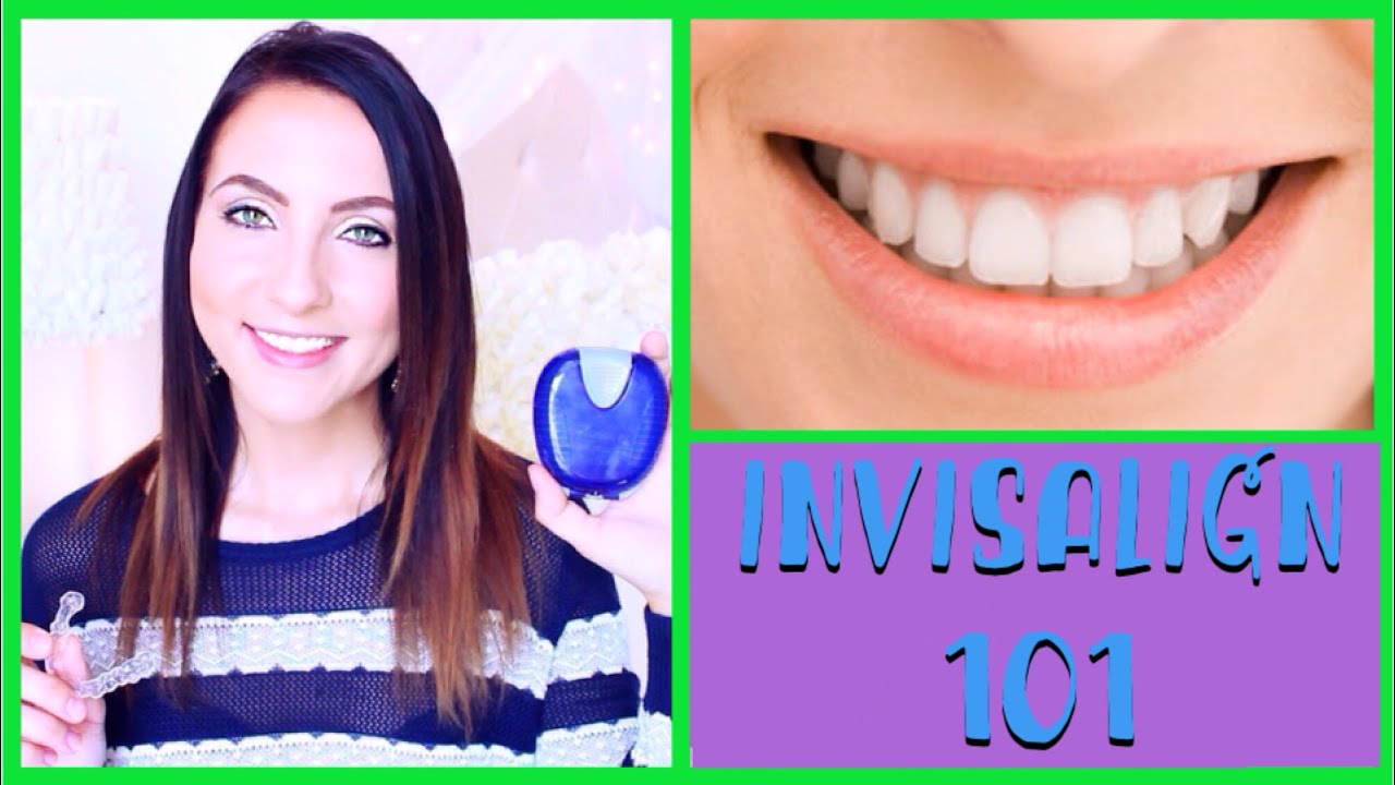 Invisalign: My Experience - YouTube