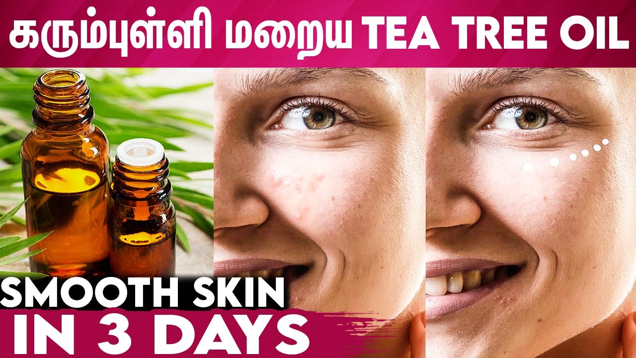 Beauty Benefits Of Tea Tree Oil | Reduce Wrinkles, Skin Pigmentation ...