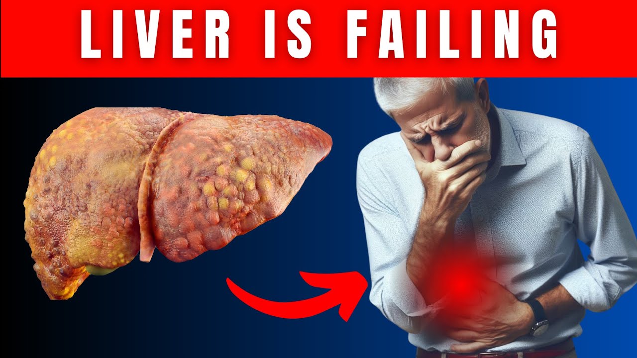 10 Signs FATTY LIVER Are Crying For Help - YouTube