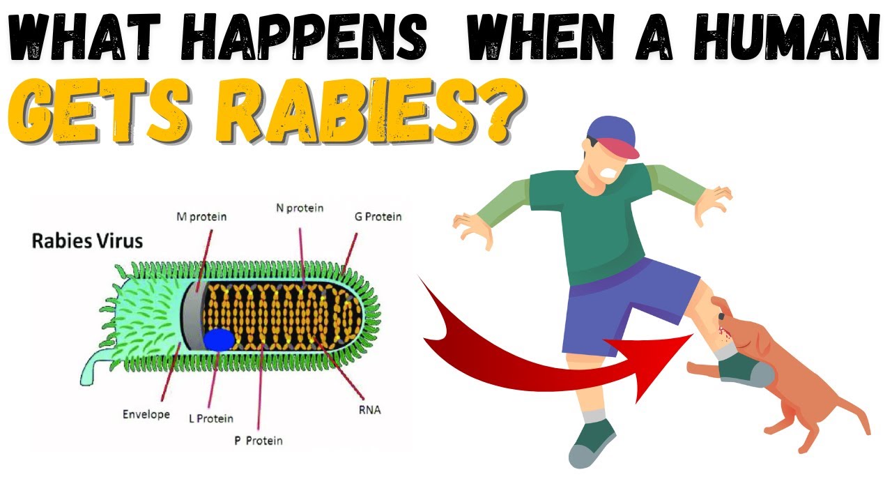 What Happens When a Human Gets Rabies? - YouTube