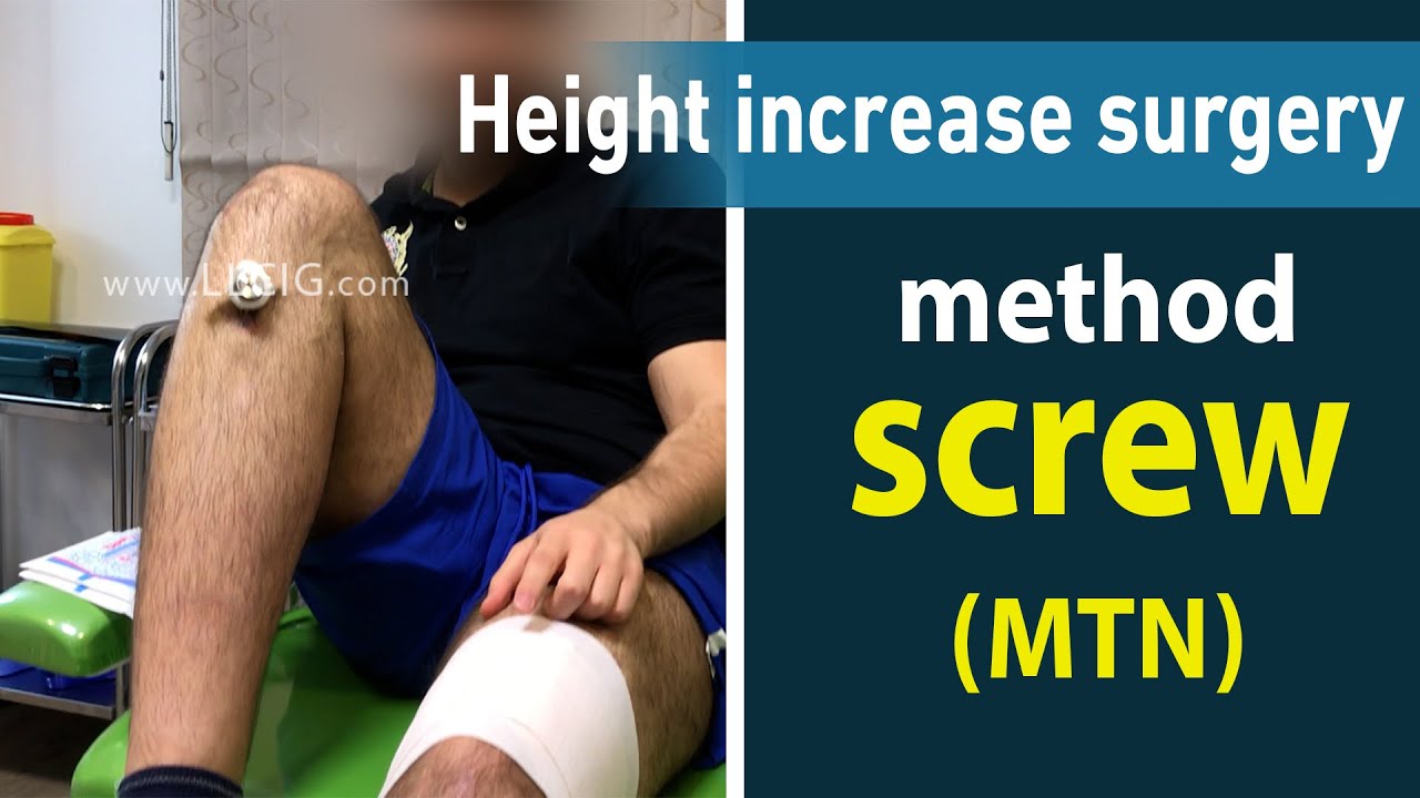 Height increase surgery MTN method - YouTube