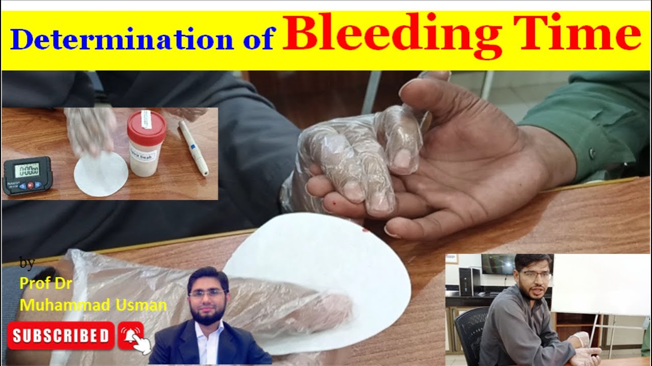 Bleeding Time | Hematology Practicals | Physiology #practical - YouTube