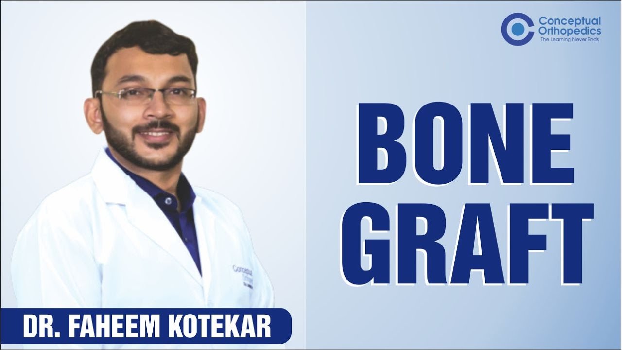 Bone Graft by Dr Faheem Kotekar | Conceptual Orthopedics - YouTube