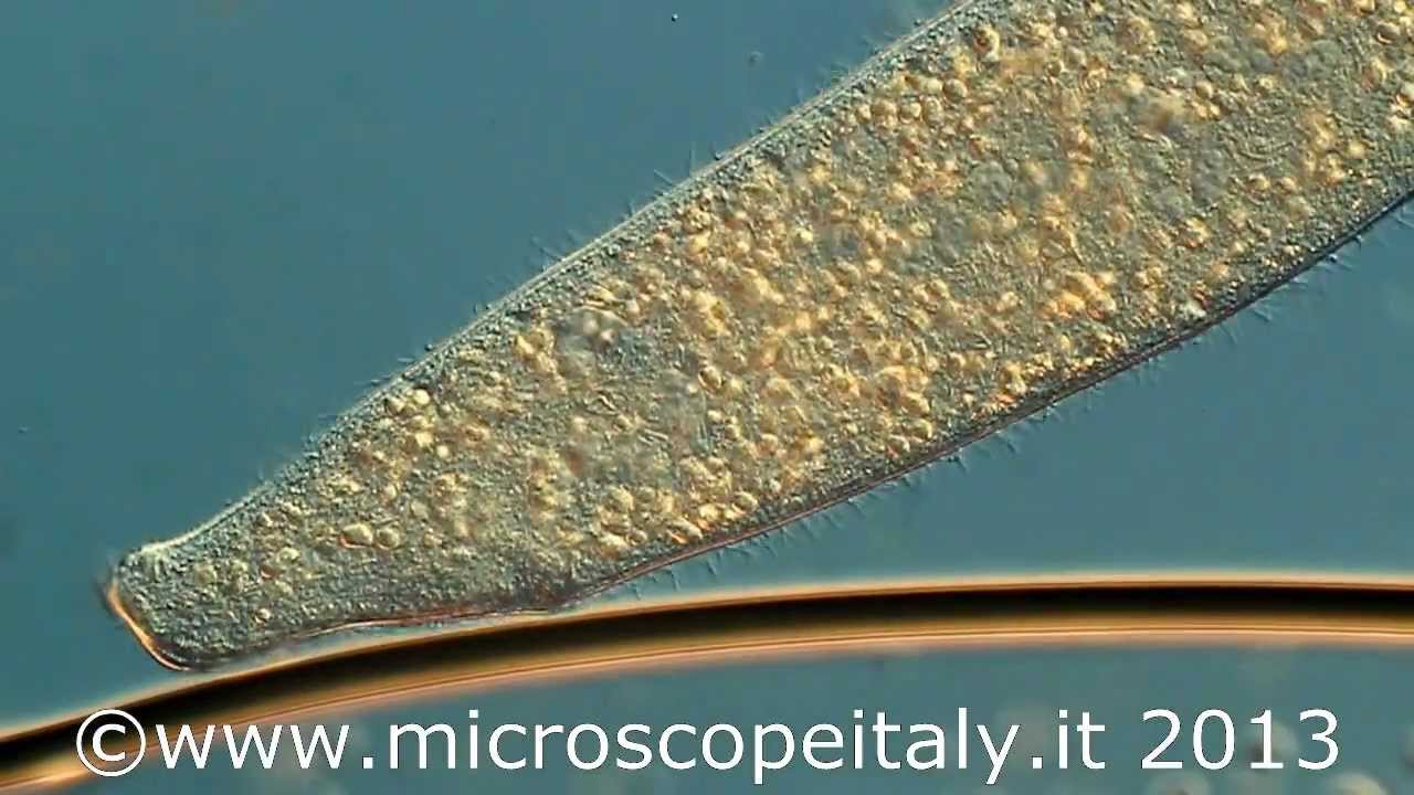 Big ciliate - YouTube
