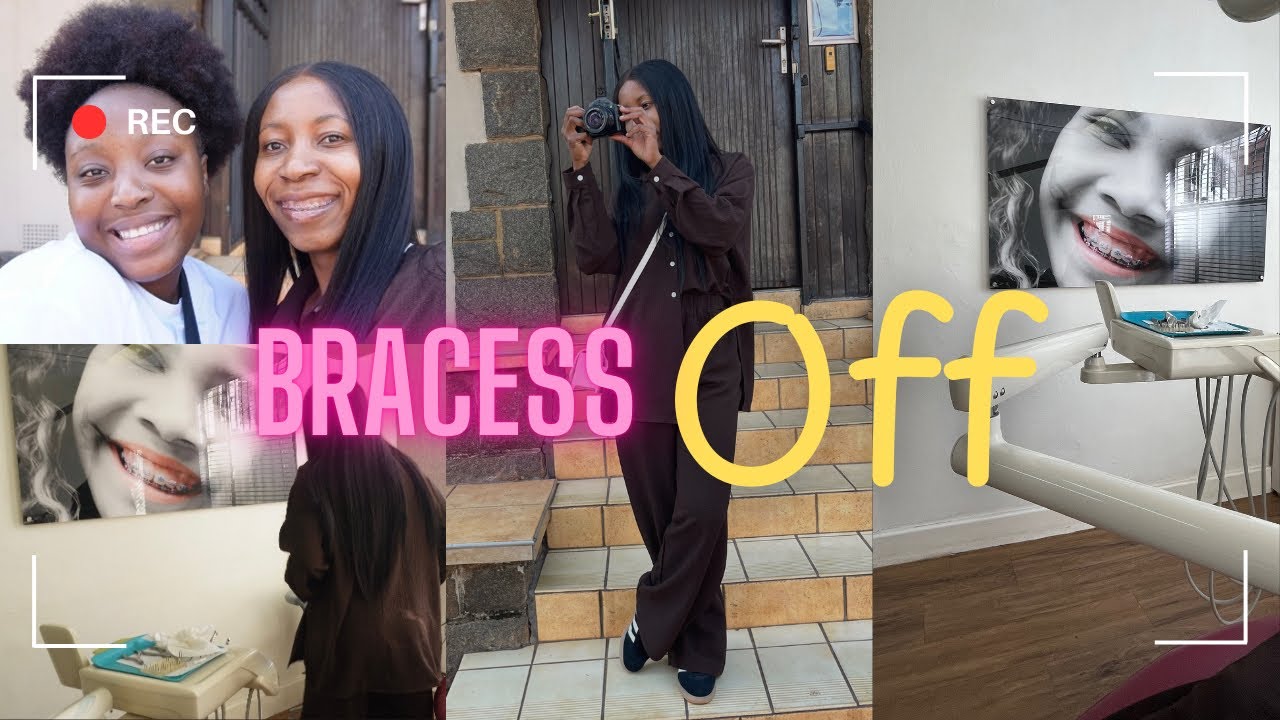 GETTING MY BRACES OFF *finally* - YouTube