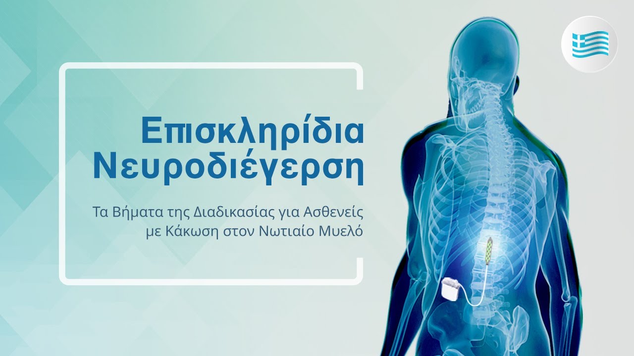 Επισκληρίδια Νευροδιέγερση: Τα Βήματα της Διαδικασίας για Ασθενείς με ...