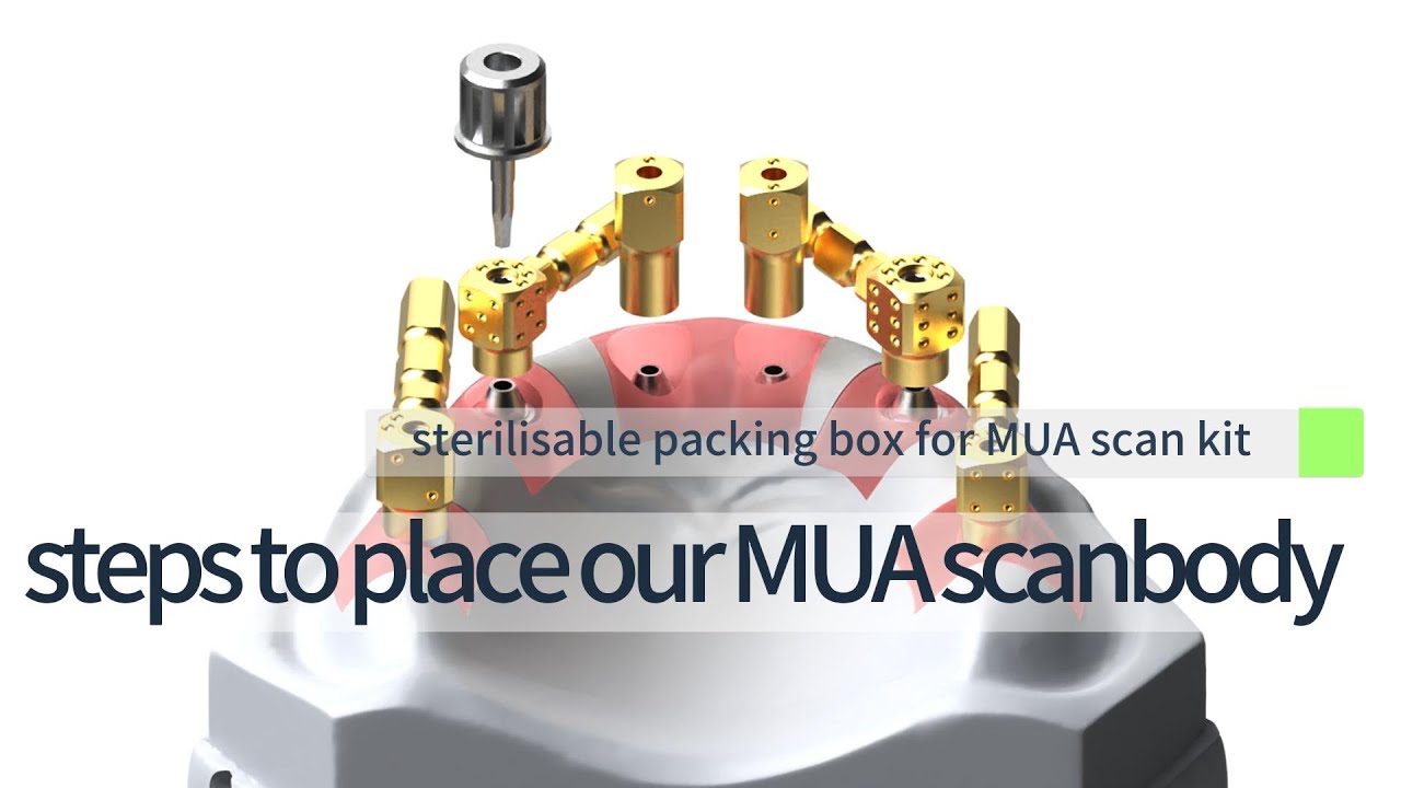 M6 MUA scan kit placement steps - YouTube